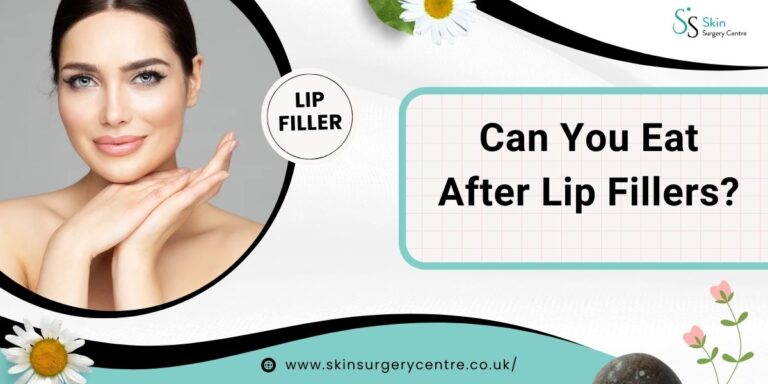 Can You Eat After Lip Fillers? UK Recovery Guide