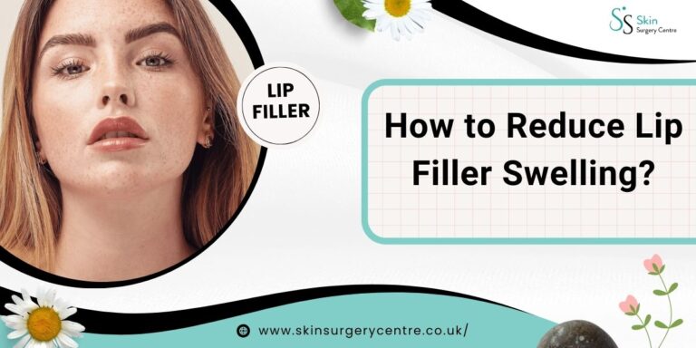 How to Reduce Lip Filler Swelling – Expert UK Guide